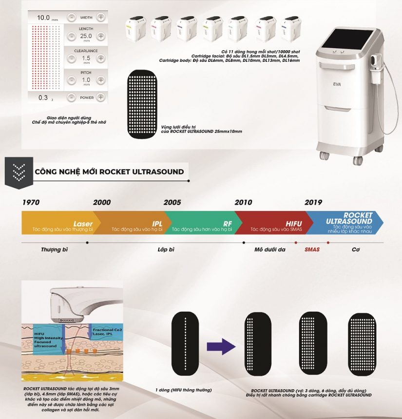 Công nghệ ROCKET ULTRASOUND ™ và cách thức hoạt động của nó