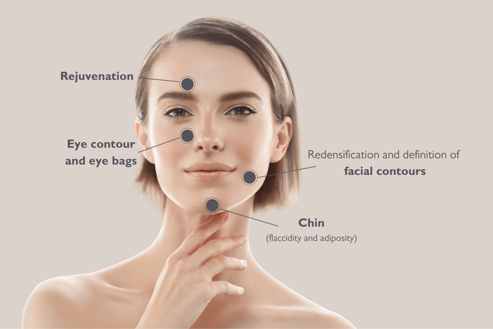 Công nghệ xóa nhăn nâng cơ RF đơn cực Symmed Elite