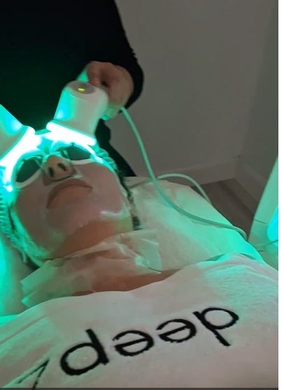 Chào Mừng Deep2 - Bước Đột Phá Mới Tại Estetica Kurae